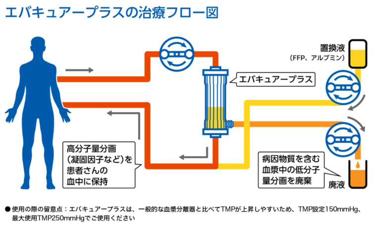 エバキュアープラス | 製品情報一覧 | 旭化成メディカル血液浄化事業部医療従事者向けWEBサイト