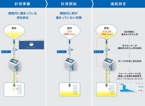 FIZE kUO | 製品情報一覧 | 旭化成メディカル血液浄化事業部医療従事者向けWEBサイト